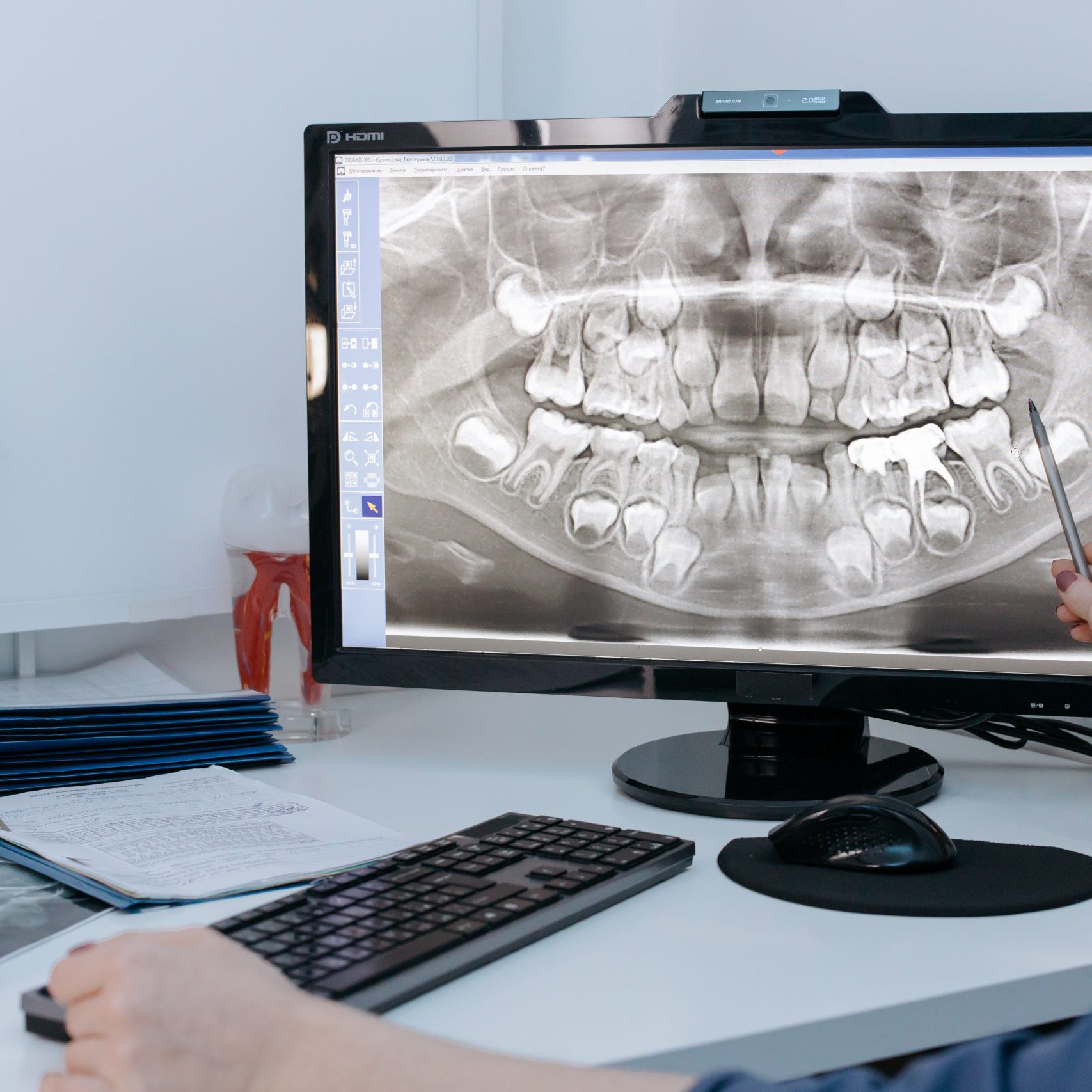 Advanced Technology - Ace Endodontics Spring